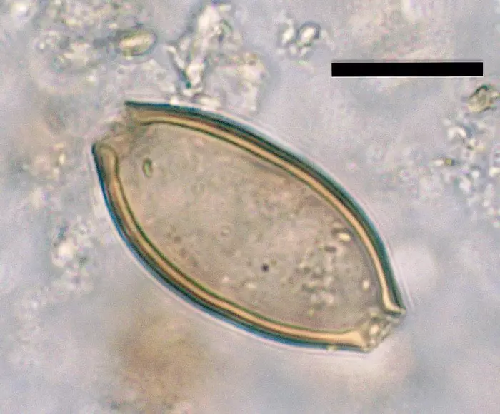 Un huevo microscópico de tricocéfalo del orinal de la antigua Roma. La barra de escala negra representa 20 micrómetros. Foto de Sophie Rabinow.