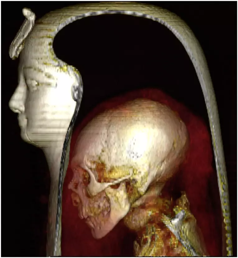 Matatu-dimensional CT mufananidzo wemusoro weakaputirwa mummy weAmenihotep I mune yeruboshwe lateral maonero anobvumira kuonesa kwechikamu chechikamu: mask, musoro wemummy, uye mabhandeji akatenderedza. Nekuda kwaS. Saleem naZ. Hawass.