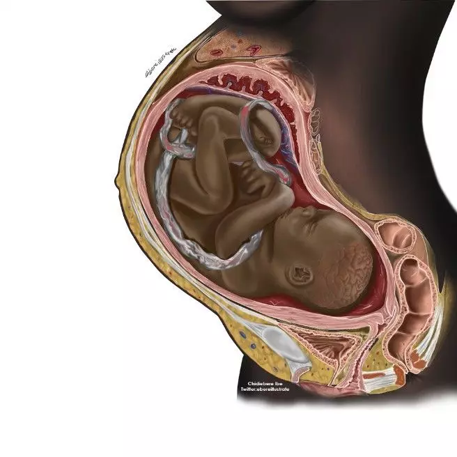 Kāds Nigērijas medicīnas students prātoja, kāpēc viņa mācību grāmatās ir attēloti tikai baltie pacienti. Tāpēc viņš uzzīmēja savas ilustrācijas — un tās kļuva plaši izplatītas