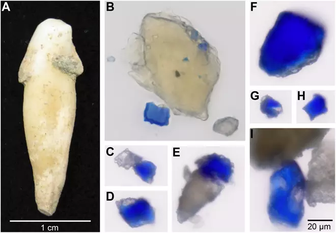 Spor af lapis lazuli blev fundet i tandstenen hos en kvinde, der boede i et tysk kloster fra det 12. århundrede, hvilket fik forskere til at tro, at hun var en meget dygtig kunstner, der arbejdede på illuminerede manuskripter. Udlånt af Science Advances.